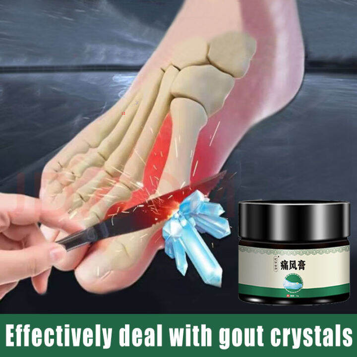 Gout Treatment Cream Pain Relief Arthritis Rheumatism skin care ...