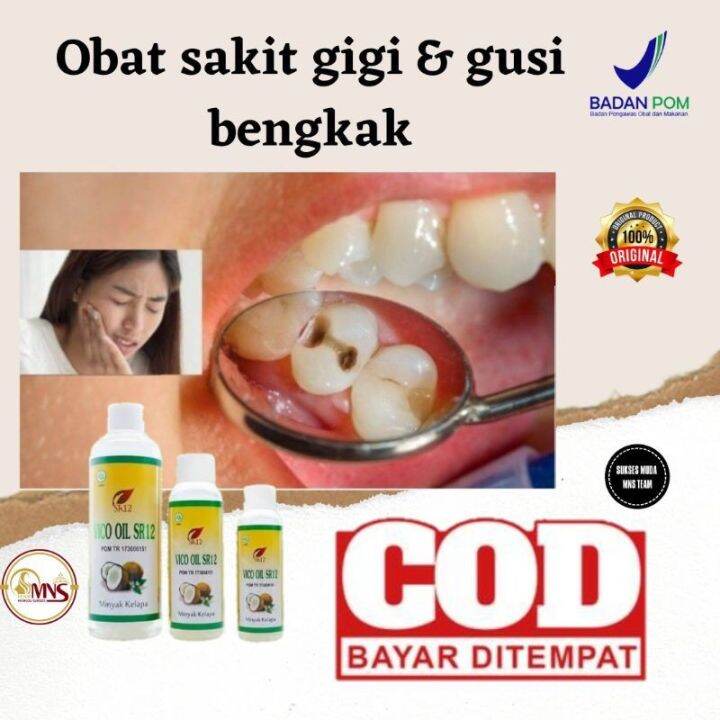 VCO SR12 ORIGINAL AMPUH OBAT SAKIT GIGI DAN GUSI / OBAT GUSI BENGKAK / OBAT GIGI BERLUBANG ...