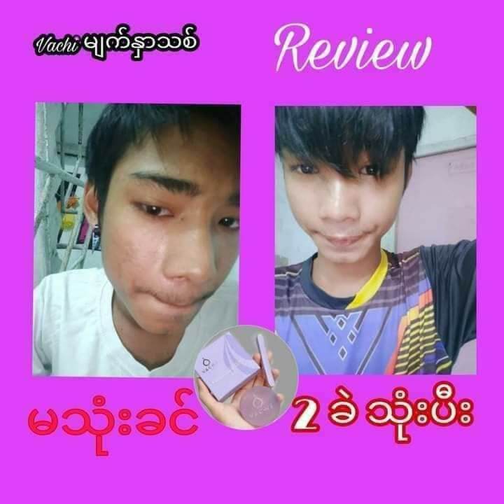 ေဆာင္းတြင္းအျဖစ္မ်ားတဲ့ မ်က္နာေျခာက္တာ အသားပက္တာေတြကို အထိေရာက္ဆုံး