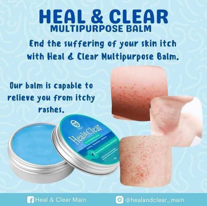 heal & clear balm | Lazada PH