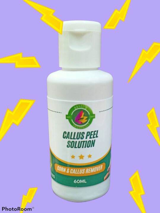 KALYO PEEL/CALLUS AND CORN PEELING SOLUTION/KALYO REMOVER 60ml CALLUS PEEL REMIOVER SOLUTION ...