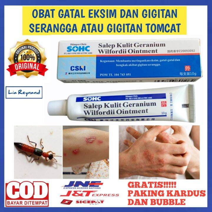 OBAT GATAL EKSIM DAN GIGITAN SERANGGA ATAU GIGITAN TOMCAT | Lazada ...