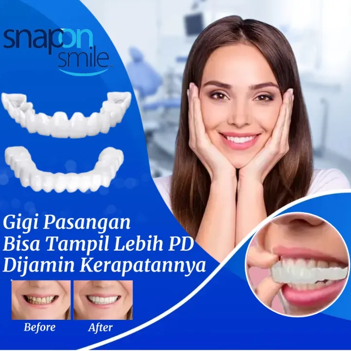 Snap On Smile Gigi Palsu 1 Set Atas Bawah - Gigi Palsu Silikon Gigi ...