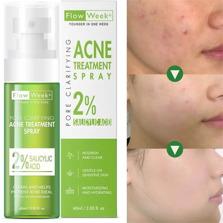 Flow Week Pimple Remover for Men Pimples and Acne Medicine for Women ...