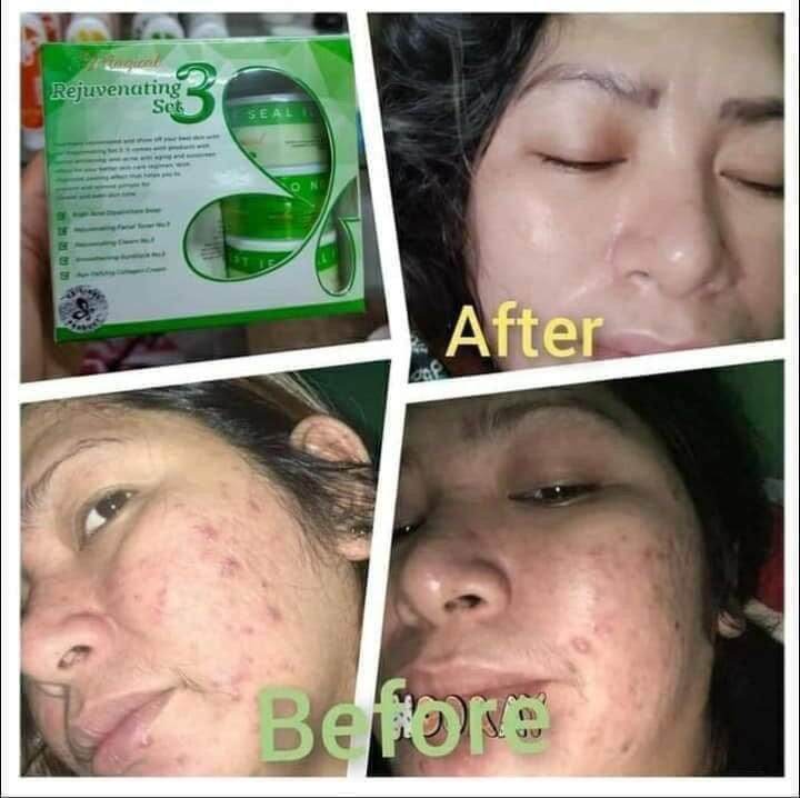 Skin Magical No.3 Set Original | Lazada