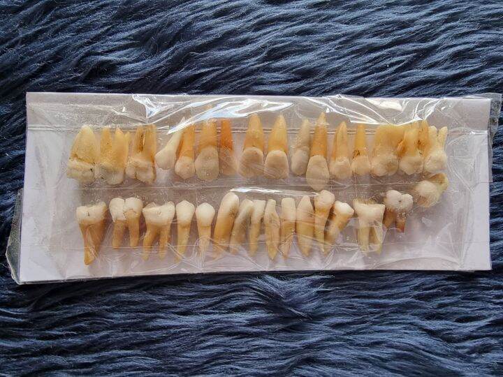 Natural Tooth Specimen Set | Lazada PH