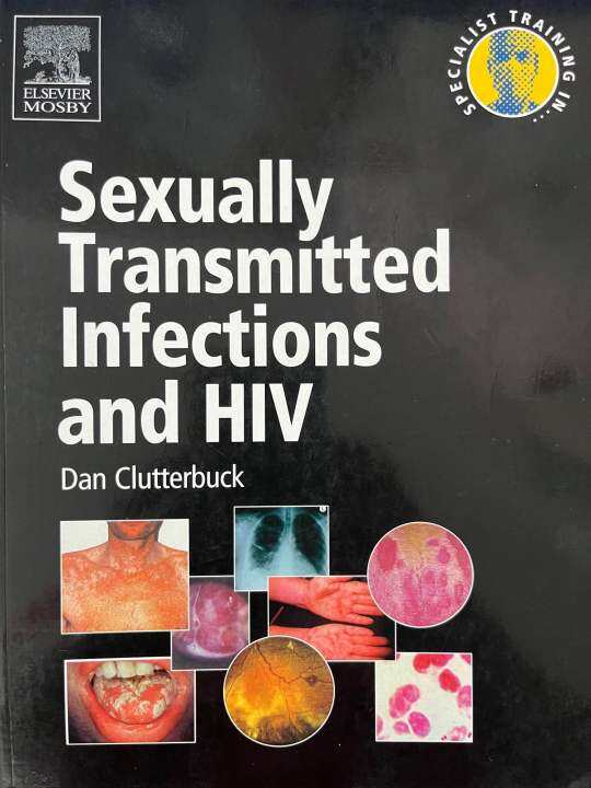 Sexually Transmitted Infections and HIV | Lazada