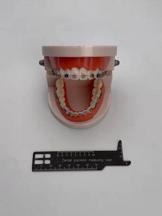 Alat Ukur Gigi Gusi Crown Veneer / Dental Esthetic Measuring Gauge ...