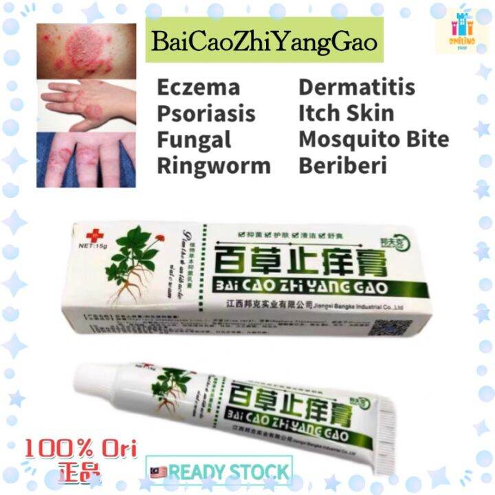 SMILING- BaiCao Eczema Psoriasis Fungal Dermatitis Beriberi Itchy Skin ...