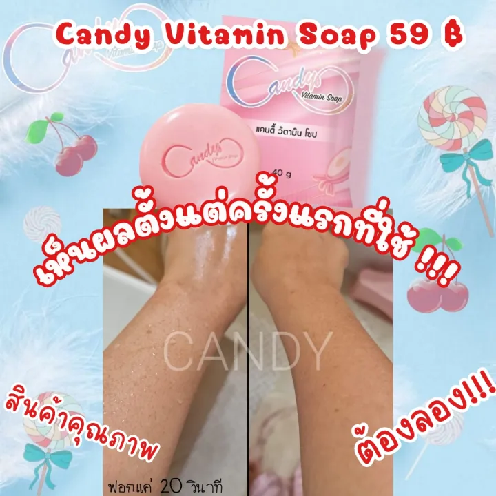 สบู่แคนดี้ วิตามินโซป CANDY VITAMIN SOAP | Lazada.co.th
