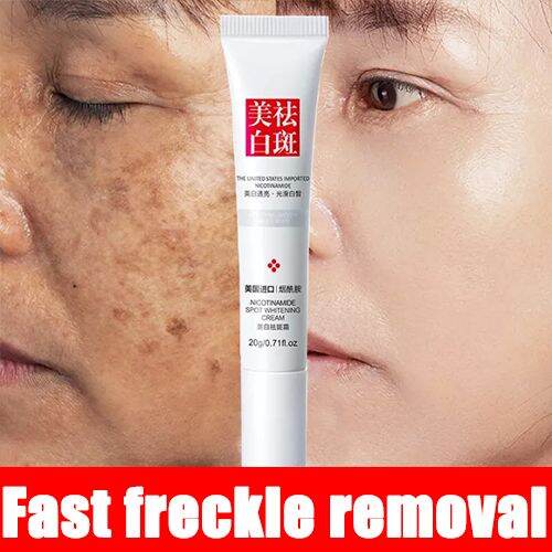 (Buy 1 Take 1)Effective japanese melasma cream whitening and freckle ...
