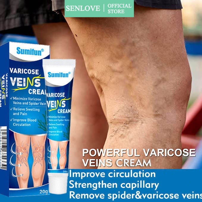 SENLOVE Sumifun Varicose Veins Remover Effective Original Varicose ...