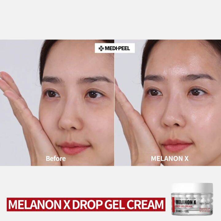 [MEDIPEEL Official] [PIGMENTATION CARE] Melanon X Drop Gel Cream 50g ...
