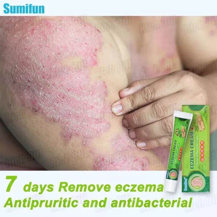 Effective Sumifun Eczema Treatment Cream gamot sa kati kati sa balat ...