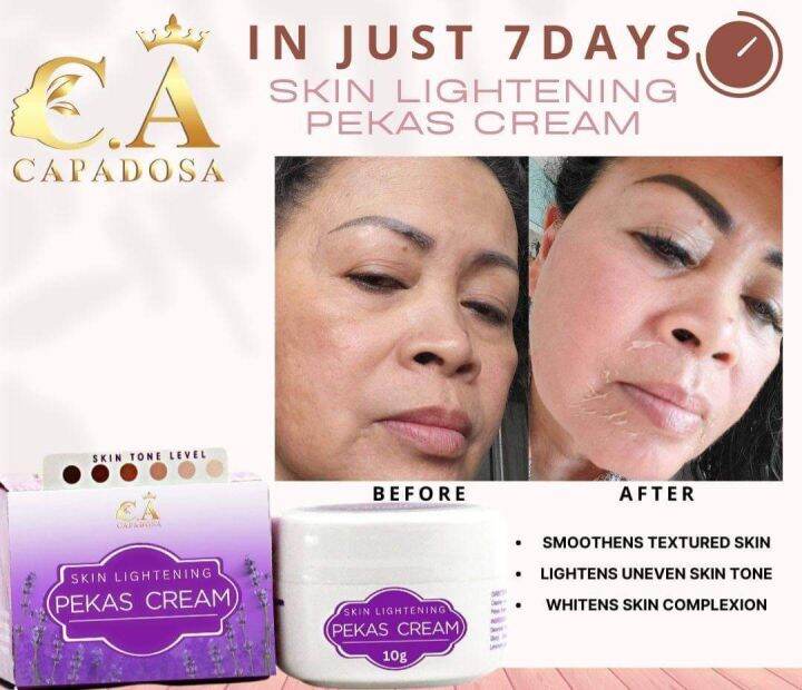 Capadosa Pekas Eraser Cream | Botox Cream with SPF 70 Removes Darkspots ...