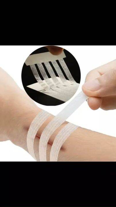 Sterile First Aid Wound Skin Closure Surgical Tape Without Sutures ...