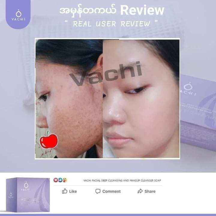 1ခဲ120ဘတ္ Vachi မ်က္နွာသစ္ | Lazada.co.th