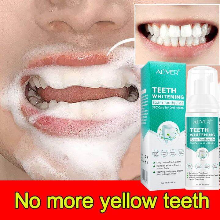 Original ALIVER Teeth Whitening Mousse Toothpaste 60ML Teeth Whitening ...