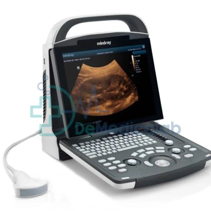 Alat USG Mindray DP10 ( Doppler ) Single Connector Dengan Convex Probe ...