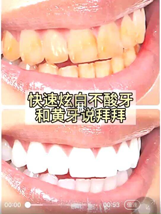 Comes 5d White Gel Teeth Quick Acting Whitening Tooth Strips Oral Care