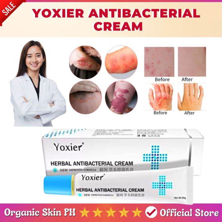 Yoxier Antibacterial Cream Ointment For Eczema Psoriasis Skin Rashes