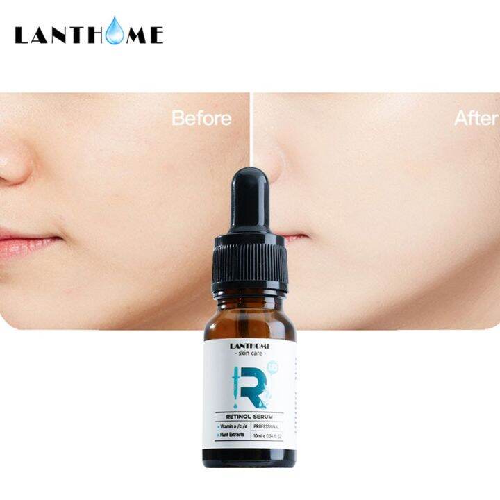 Lanthome Retinol stock solution to reduce dry and fine lines ...