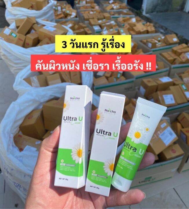 🎯ของแท้/รีวิวเยอะ🎯 [1หลอด] UltraU อัลตร้ายู ครีมณัชชา ครีมแก้โรคผิวหนัง ทาแก้คัน ผิวหนังอักเสบ ...