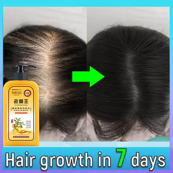 Original Ginger Shampoo Fast Powerful Hair Growth Liquid Anti Hair Loss ... Original Ginger Shampoo Fast Powerful Hair Growth Liquid Anti Hair Loss ...