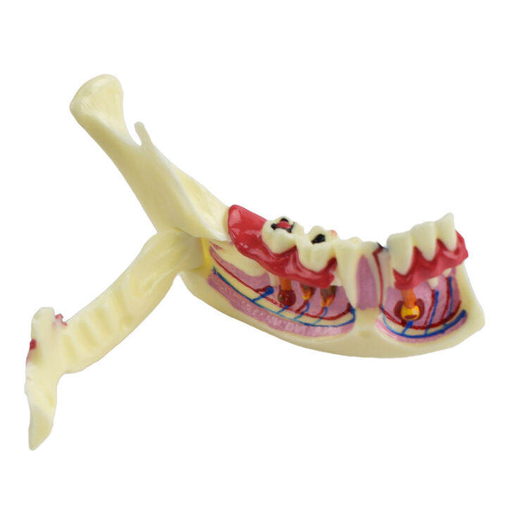 Dental Model Mandible Tissue Anatomical Model Anatomy of Gums Dental ...