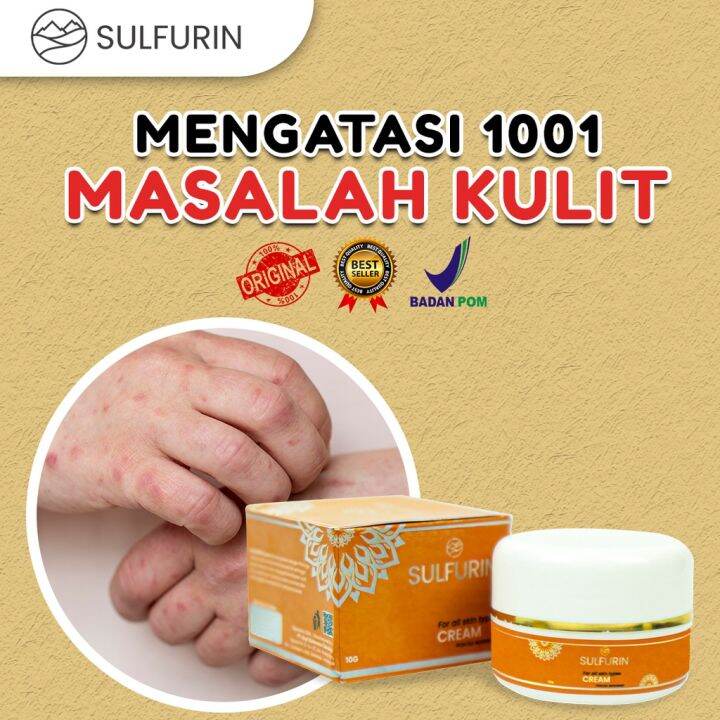 SALEB KRIM SULFURIN OBAT GATAS ATASI KADAS KURAP PANU DAN GATAL DI ...