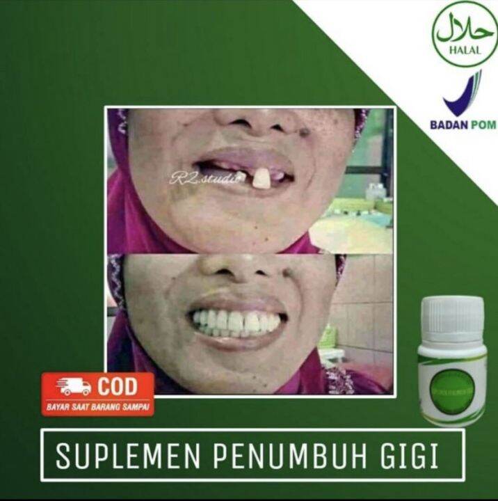 PENUMBUH GIGI ORIGINAL MENUMBUHKAN GIGI BERLUBANG, GIGI OMPONG, GIGI ...