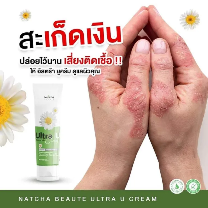 พร้อมส่ง [3ชิ้น] ครีมแก้คันของแท้ UltraU อัลตร้ายู ครีมแก้โรคผิวหนัง แก้คัน เชื้อรา ผลิตจาก ...