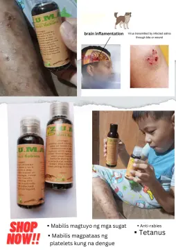 Gamot Sa Dengue Sa Bata Online | dntu.edu.vn