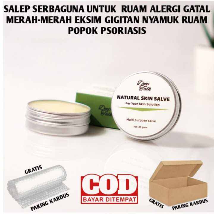 SALEP ALERGI GATAL MERAH-MERAH EKSIM GIGITAN NYAMUK RUAM POPOK ...