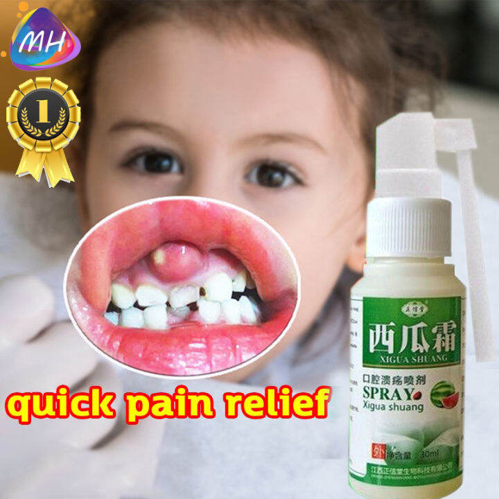 Watermelon frost oral ulcer spray 30ml To relieve bad breath tooth ...