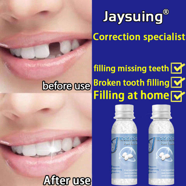 no need to go to the hospital🦷 JAYSUING Denture Adhesive Glue Repair ...