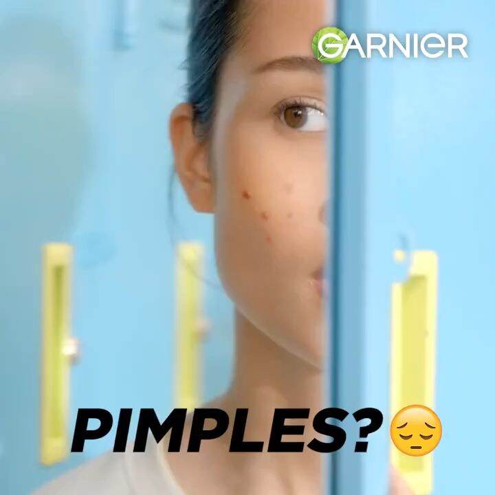 GARNIER Skin Naturals Radiance Total Anti-Acne Serum (30ml) with ...