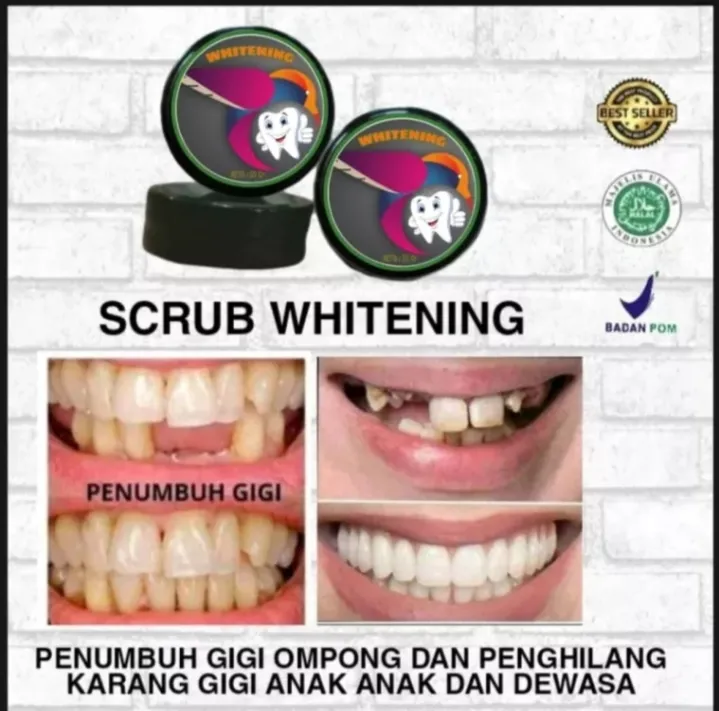 PENUMBUH GIGI DEWASA, GIGI OMPONG,KROPOS DAN BERLUBANG PALING AMPUH ...