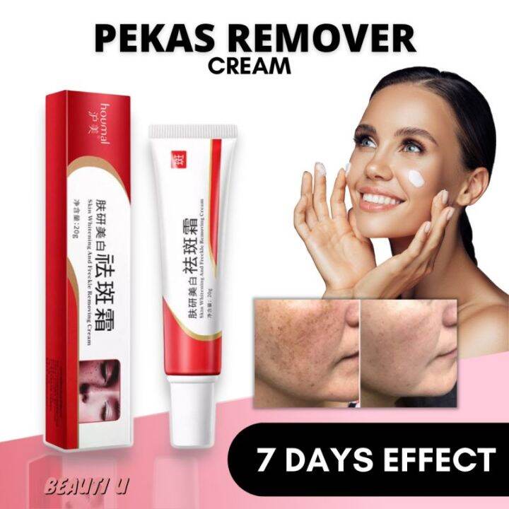 🔥Original Pekas Remover Whitening Freckle Remover Cream Remover Melasma ...