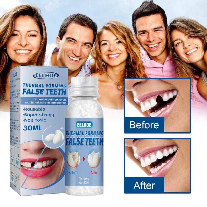 Tooth Filling Solid Denture Material Temporary Tooth DIY False Teeth ...