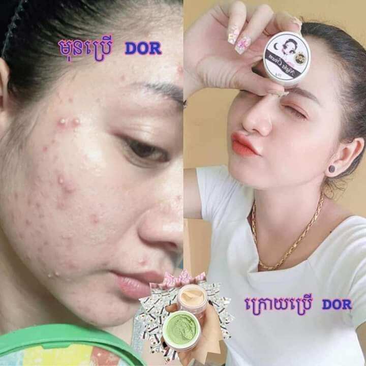 DOR night cream | Lazada.co.th