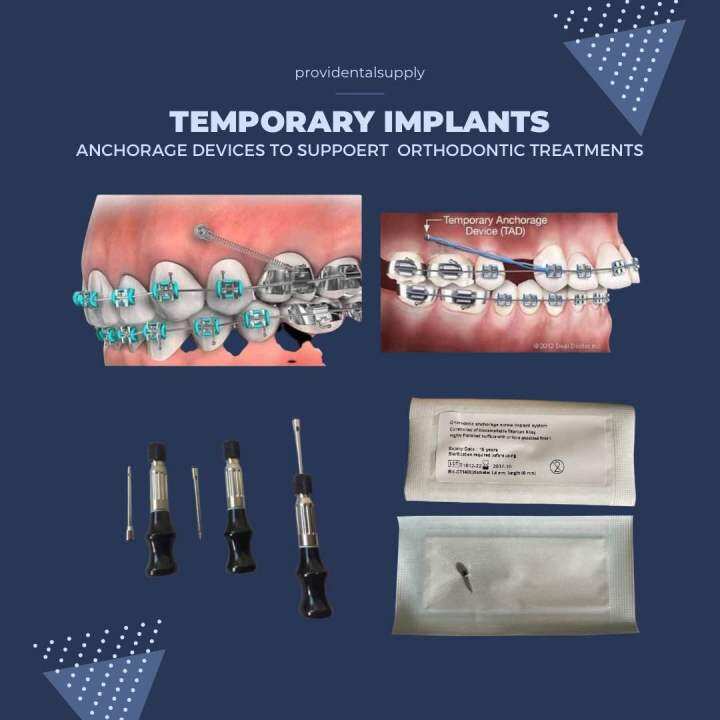 TADS Mini Screw of Dental Implants | Lazada PH