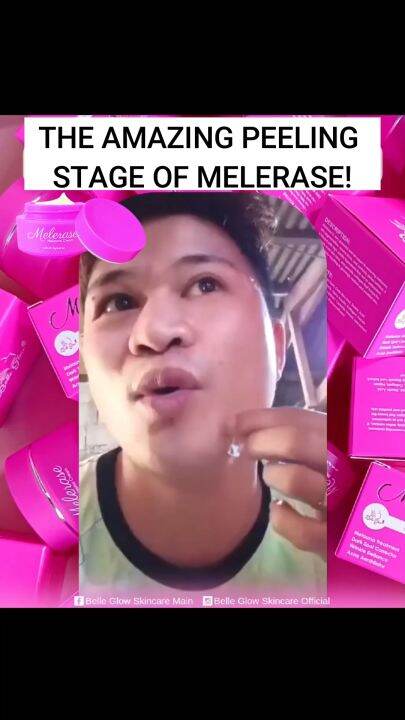 Original Melerase Melasma Cream Remover 12g Treatment for Melasma Pekas ...