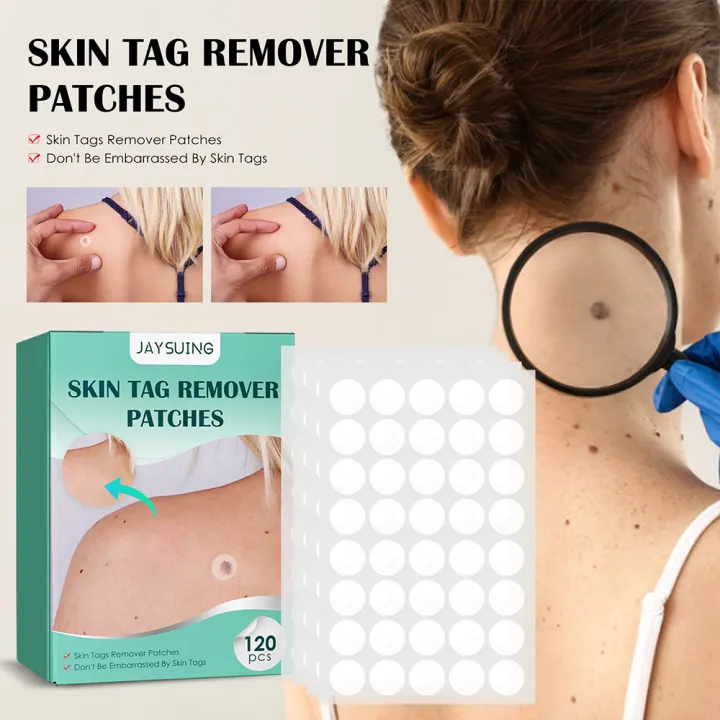 120Pcs Wart Removal Patch Skin Tag ทำความสะอาดไฝหูด Calluses Removal ...