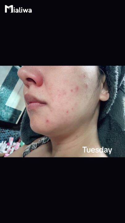 Rosmar Hydra Peeling Soap, Sabon Pampaputi Whitening Exfoliating ...