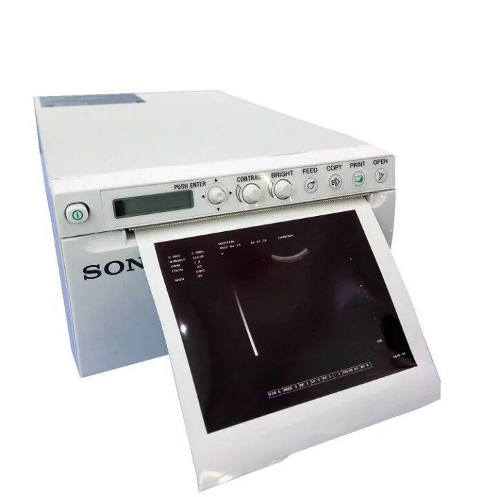PROFESSIONAL S0NY ULTRASOUND PRINTER- A6 Analog and Digital Black and ...