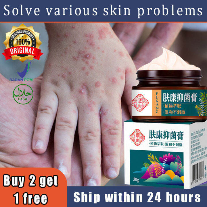 Antibacterial Psoriasis Ointment Eczema cream for skin problem 30g ...