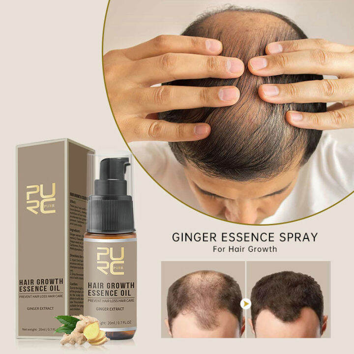 Purc Pure Natural Hair Growth Oil Ginger Hair Treatment Effective