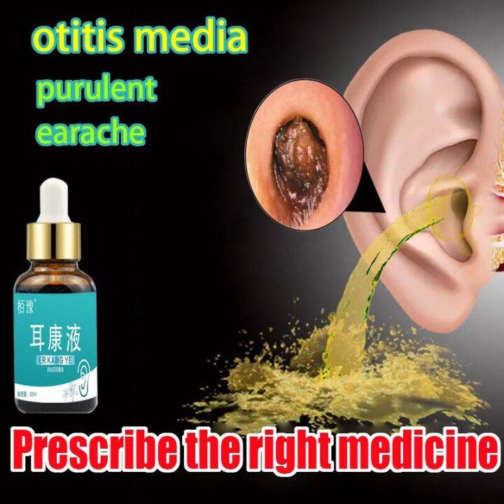 Tinnitus relief ear drops Earwax Cleaner Liquid ear wax softener ear ...