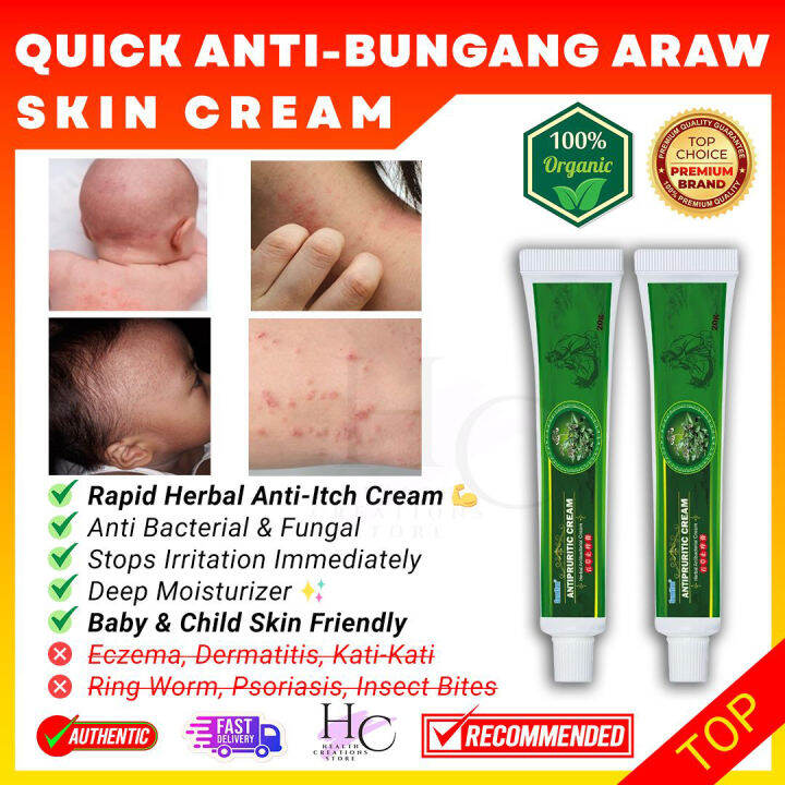 SUMIFUN Anti Pruritic Gamot Sa Kati Kati Sa Balat Eczema Treatment Cream Gamot Sa Bungang Araw ...